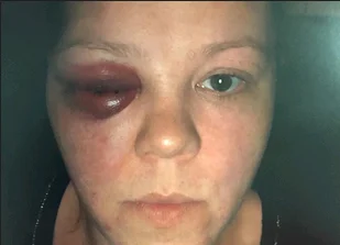 Amy-Connelly-police-hit.png | The Demon's Den